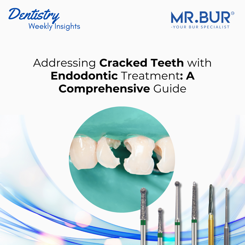 Understanding and Reducing Black Triangles in Dentistry: When to Use ...