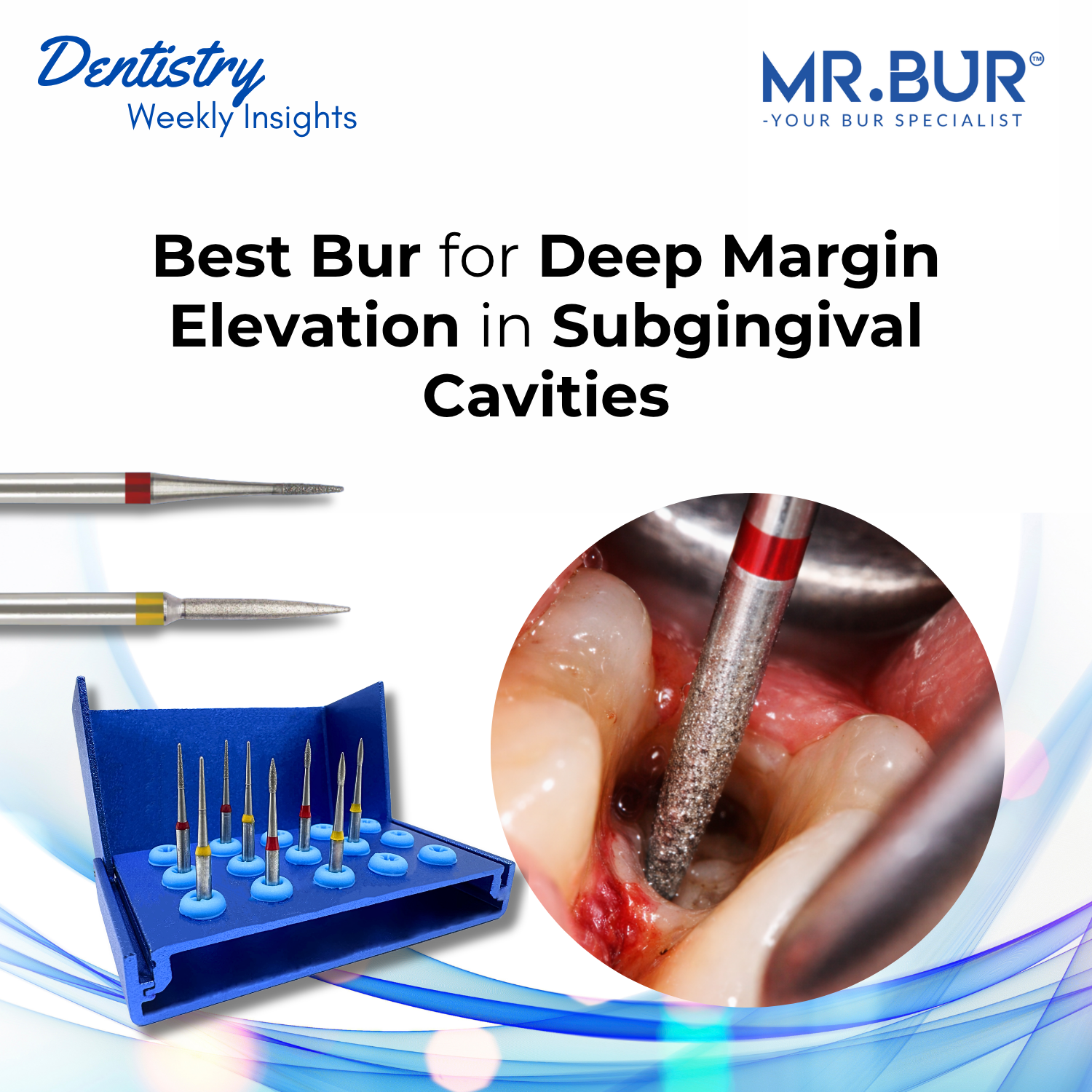 Best Bur for Deep Margin Elevation in Subgingival Cavities – Mr Bur