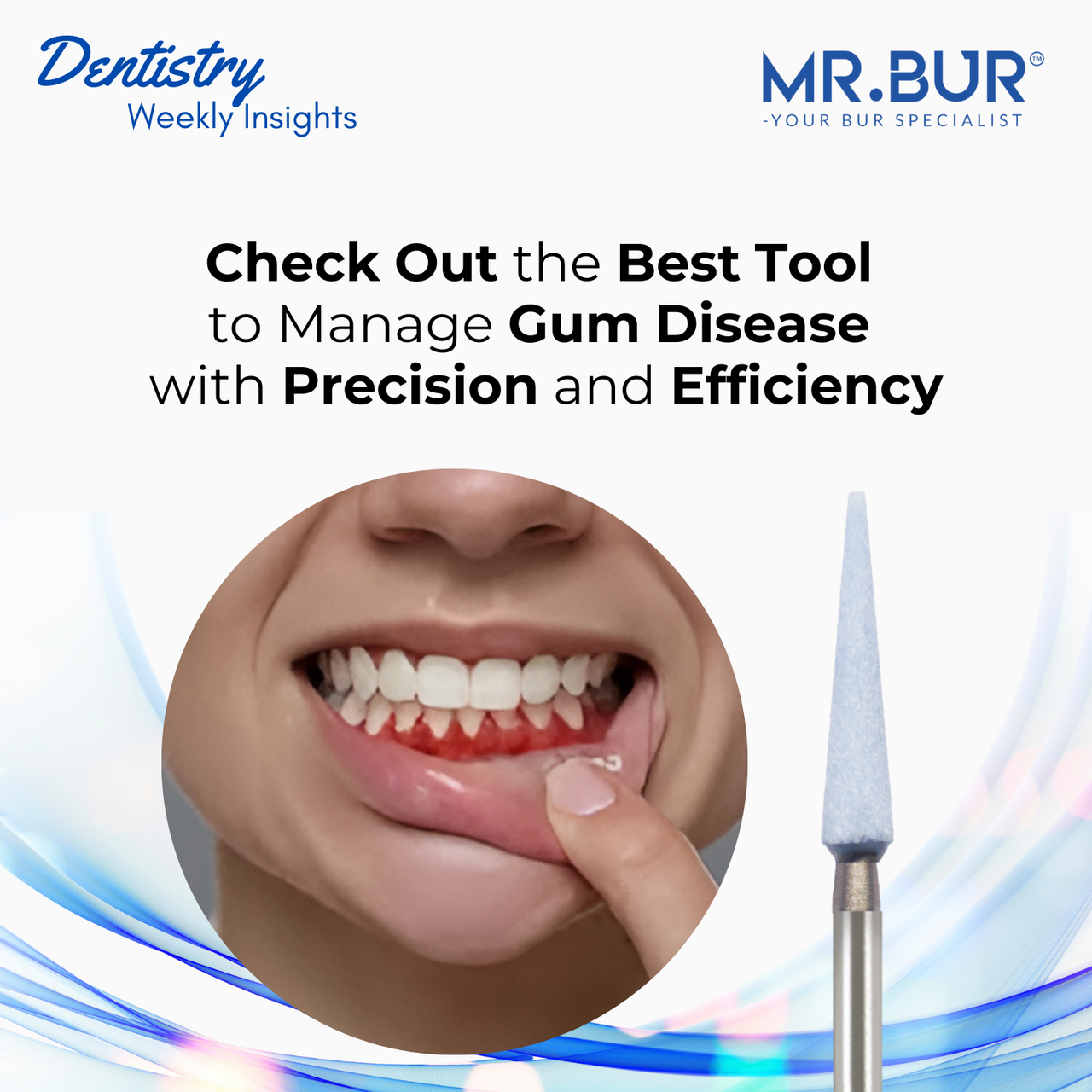 Step-by-Step Guide to Crown and Bridge Preparation Using Retraction ...
