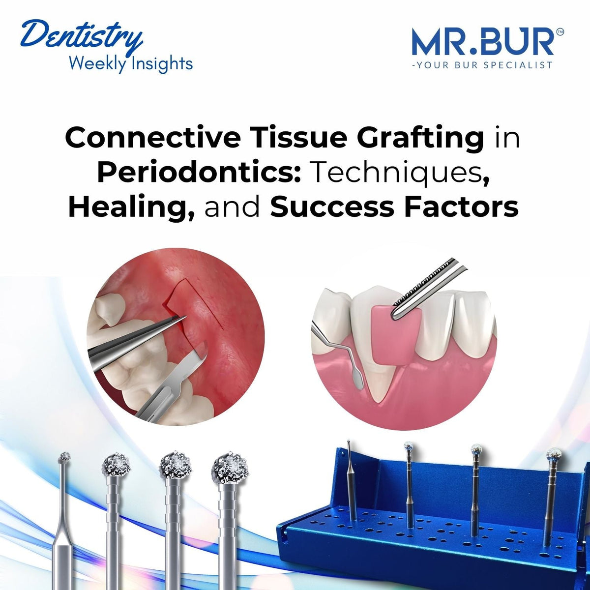 Pedicle Grafts in Periodontics: A Comprehensive Guide – Mr Bur