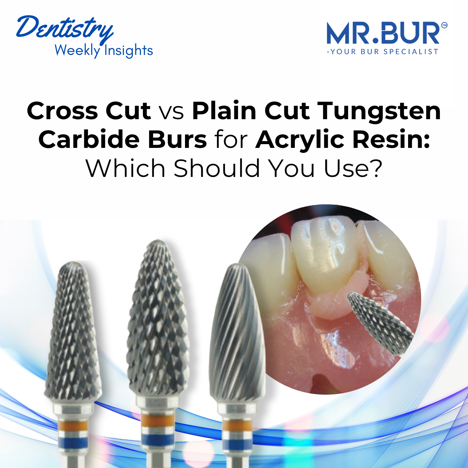 Cross Cut vs Plain Cut Tungsten Carbide Burs: Optimizing Acrylic Resin ...