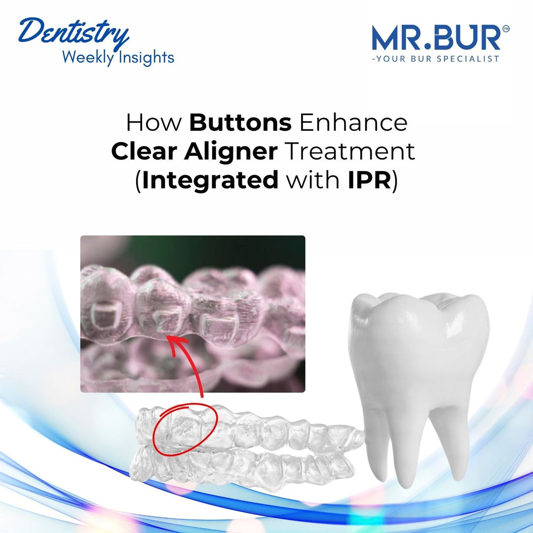 The Principles and Best Burs for Cavity Preparation in Restorative ...