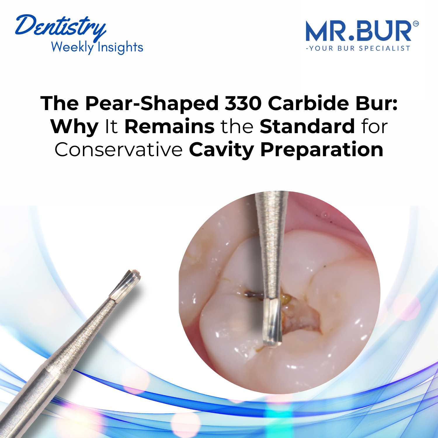 Why the 330 Pear-Shaped Carbide Bur Is Still the Best Tool for Conserv ...