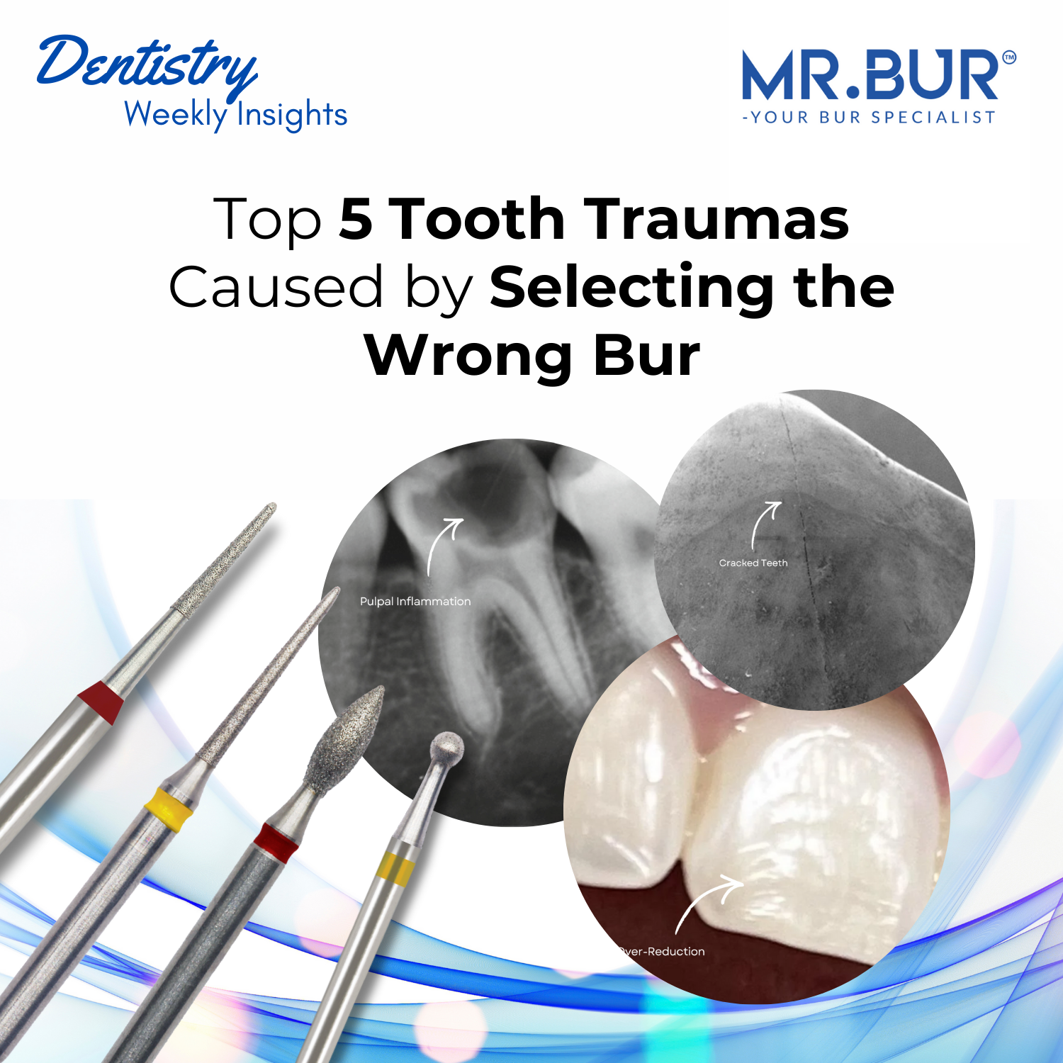 How the Wrong Bur Can Damage Teeth: Top 5 Clinical Risks in US – Mr Bur