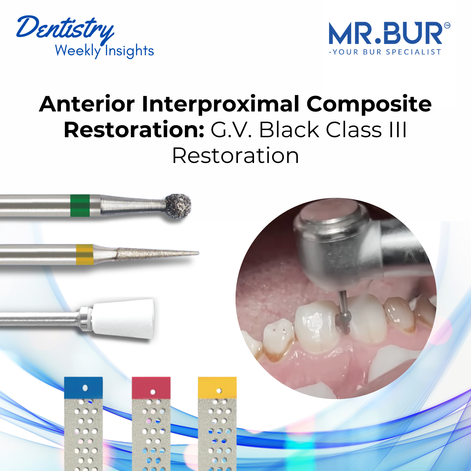 G.V. Black Class III Restorations Explained: Anterior Interproximal Co ...