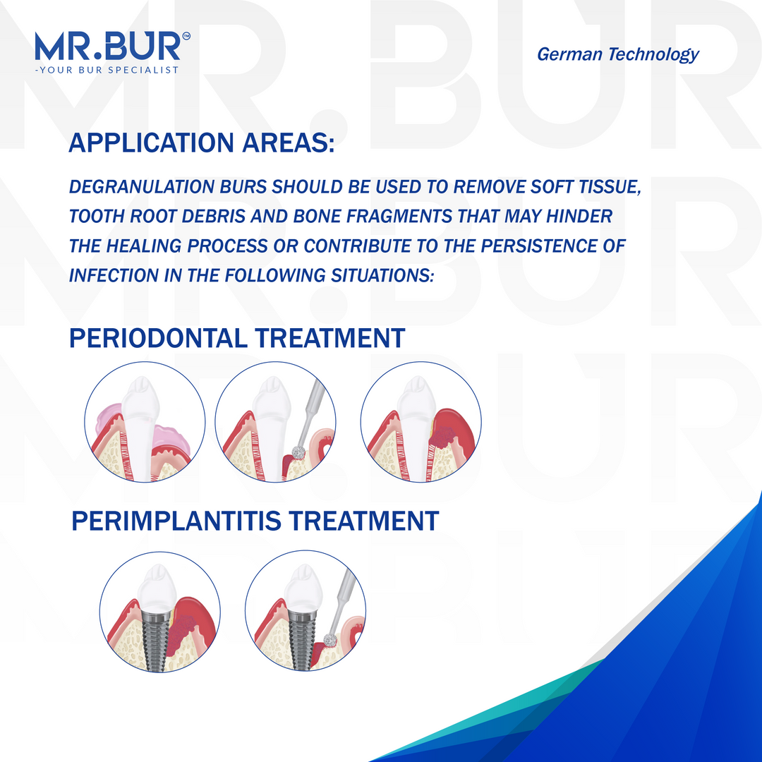 Best Degranulation Kit for Implantology, Endodontic and Periodontal ...