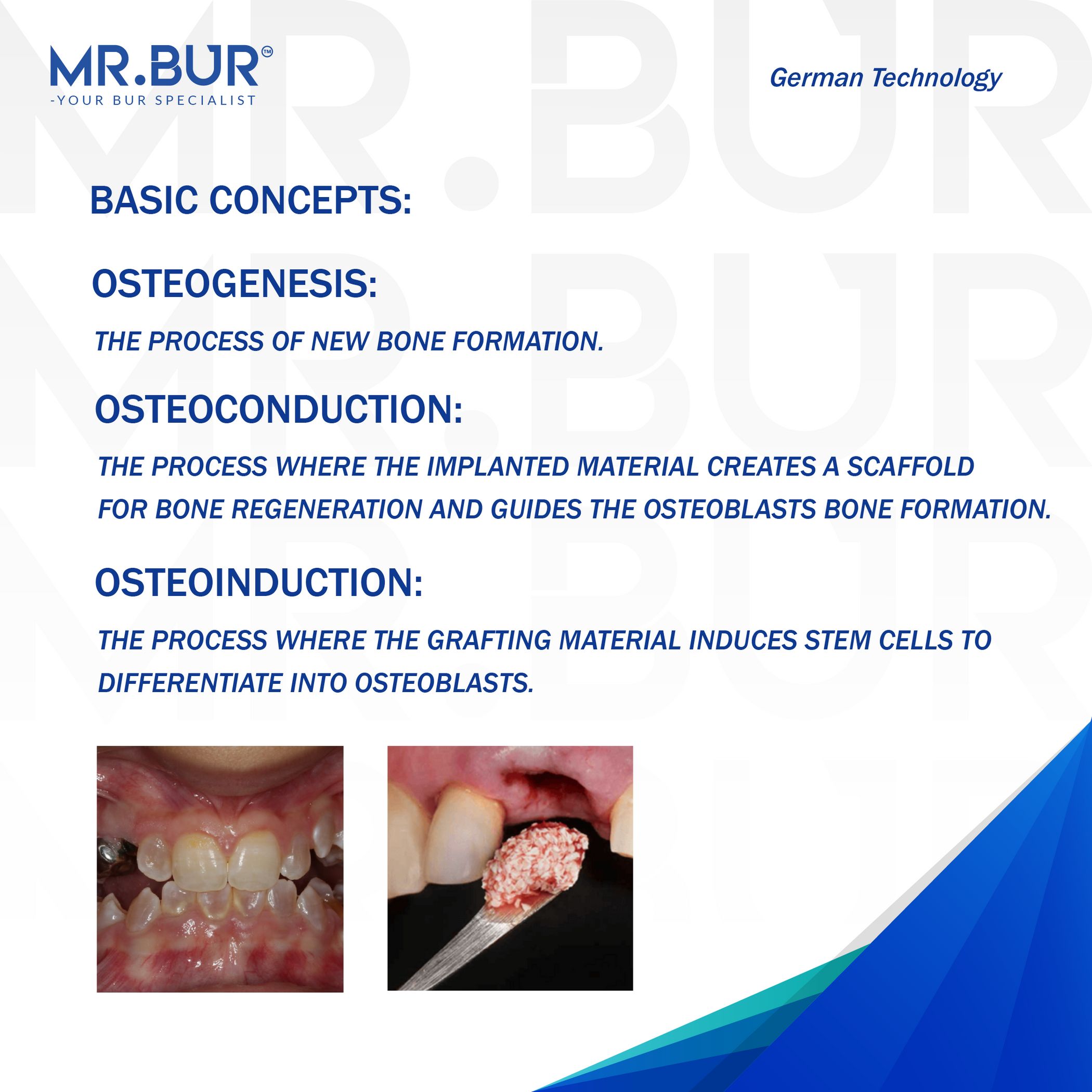 Best Degranulation Kit for Implantology, Endodontic and Periodontal ...