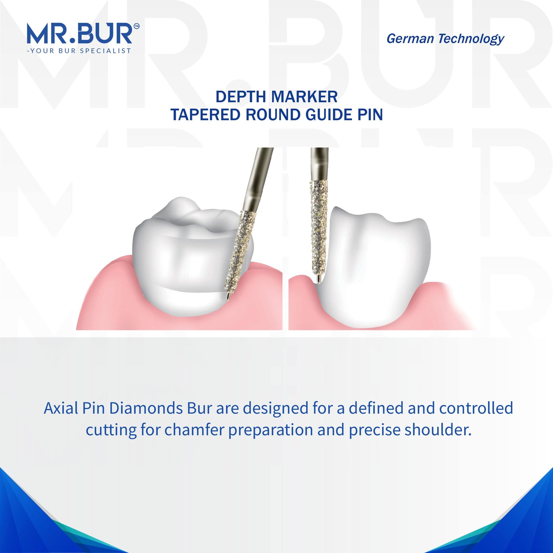 The Best Guide Pin Coarse Diamond Bur FG For Crown Preparation | MR ...