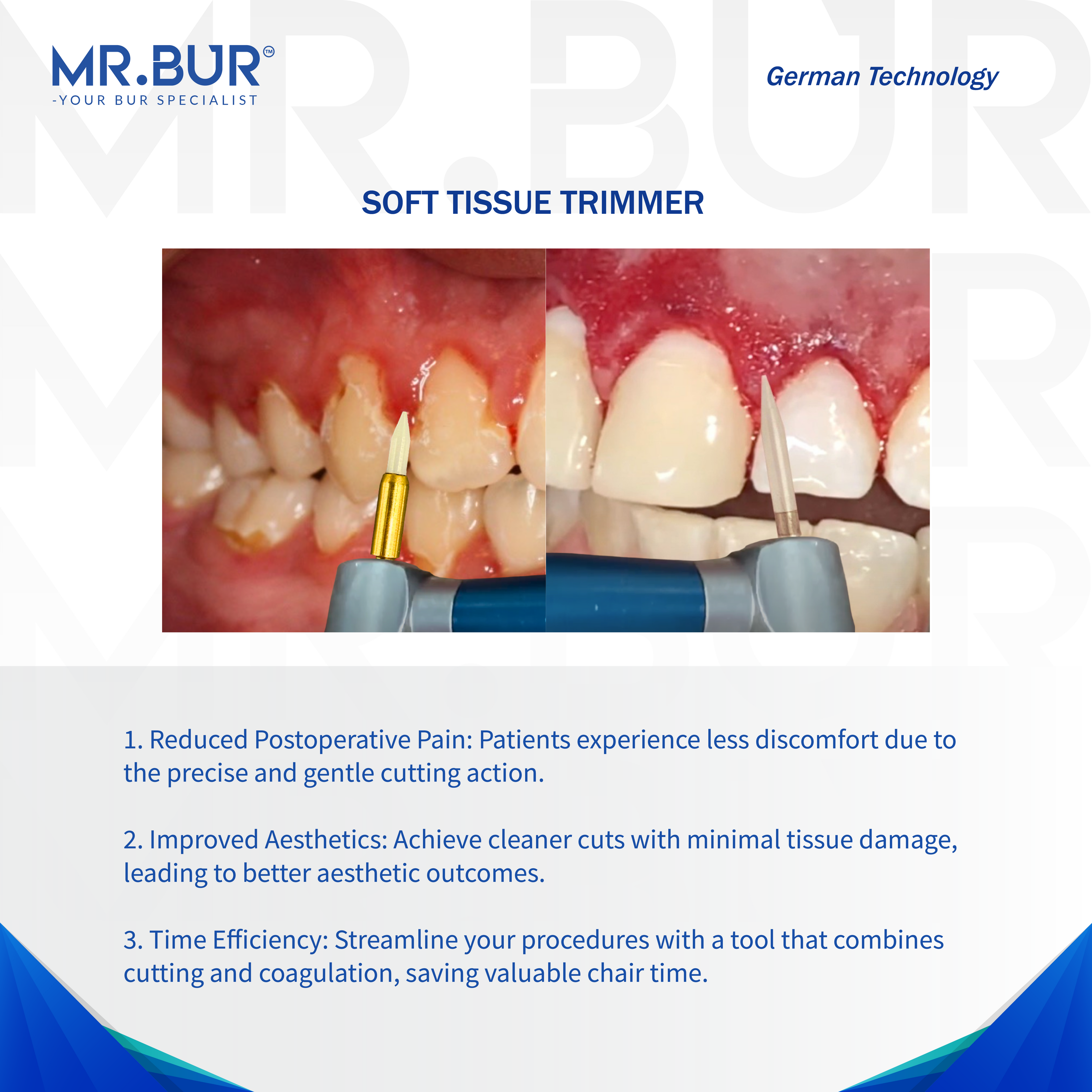 Best Ceramic Bur For Soft Tissue Trimming Bur FG – Mr Bur